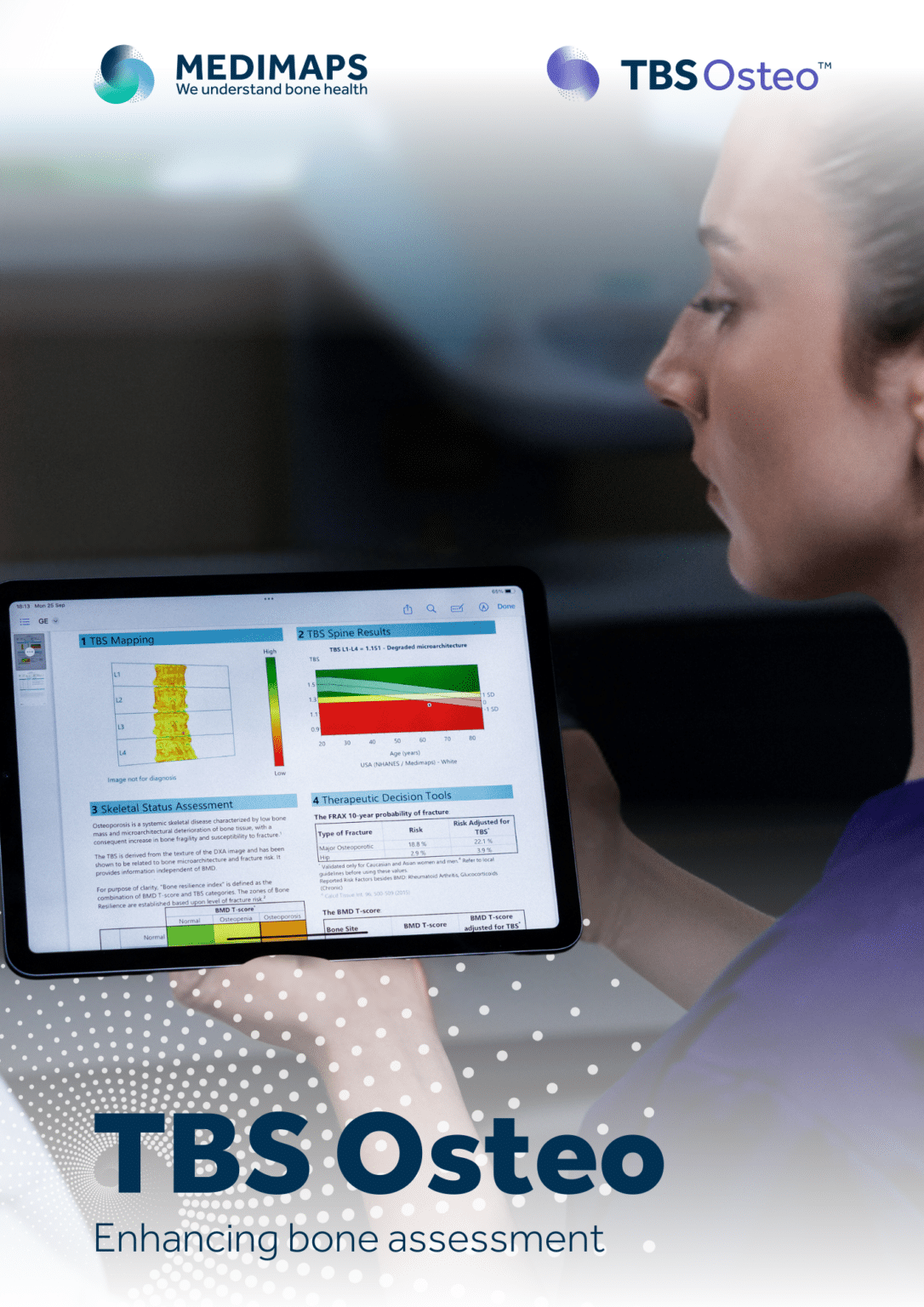 TBS Osteo: osteoporosis fracture risk assessment software - Medimaps