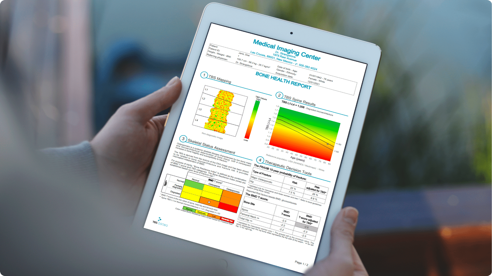 Trabecular Bone Score (TBS) - Medimaps