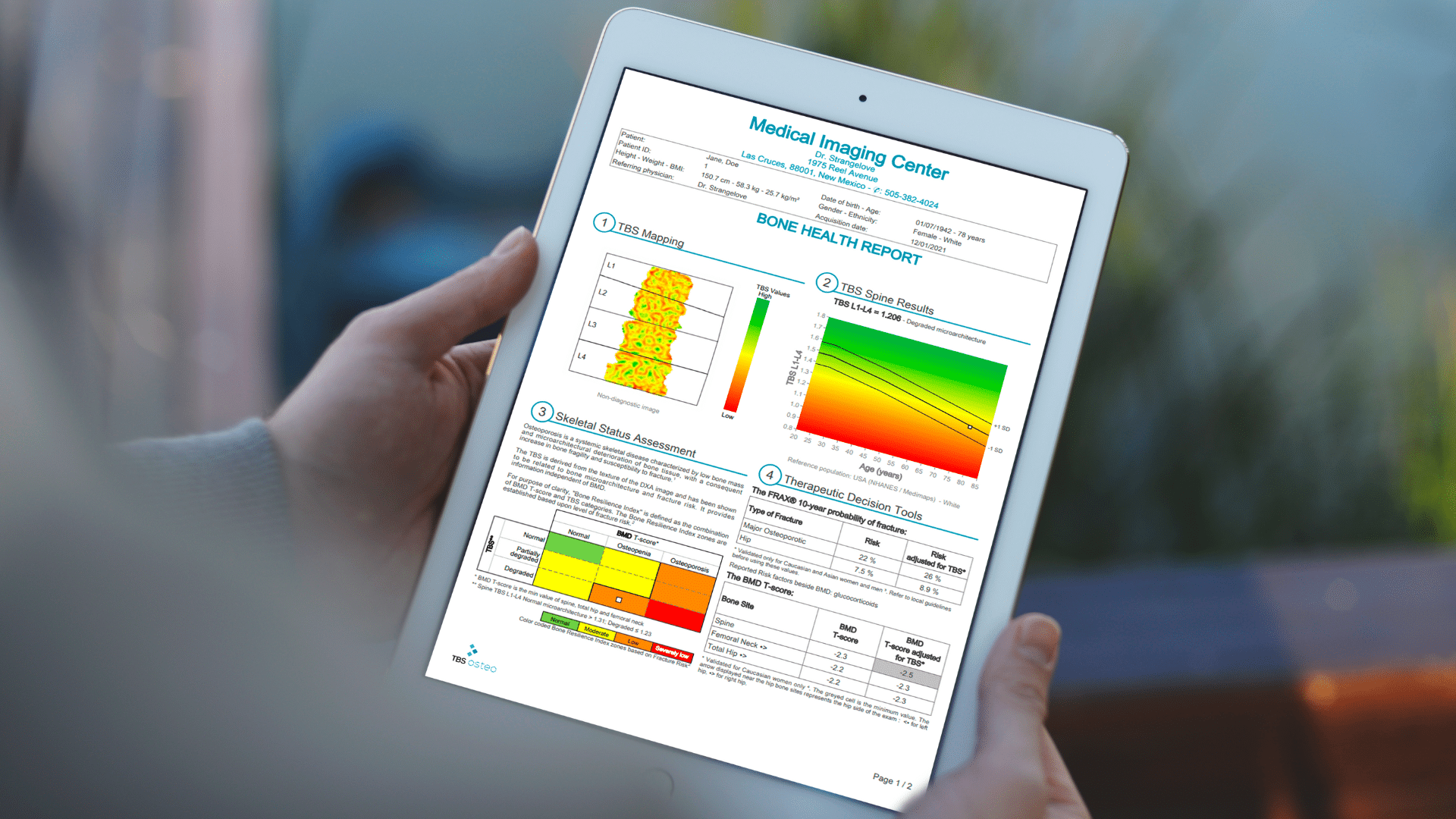 TBS Osteo: osteoporosis fracture risk assessment software - Medimaps