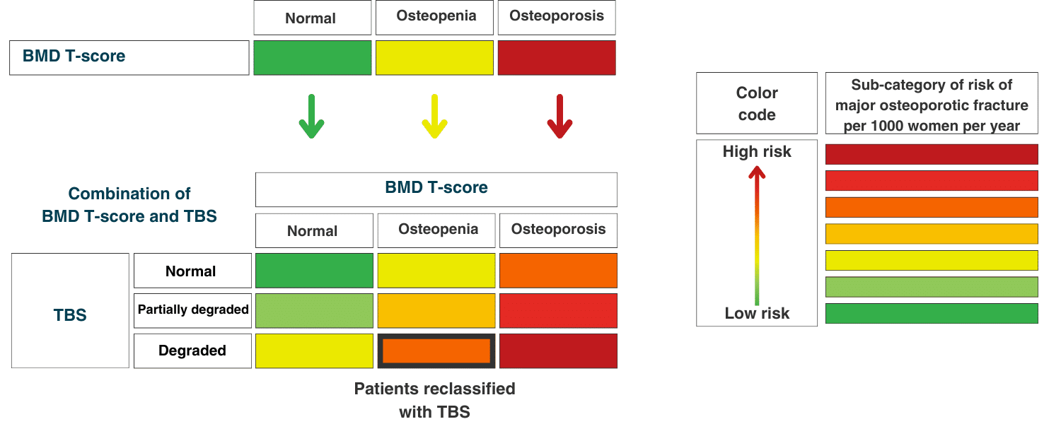 Trabecular Bone Score (TBS) - Medimaps