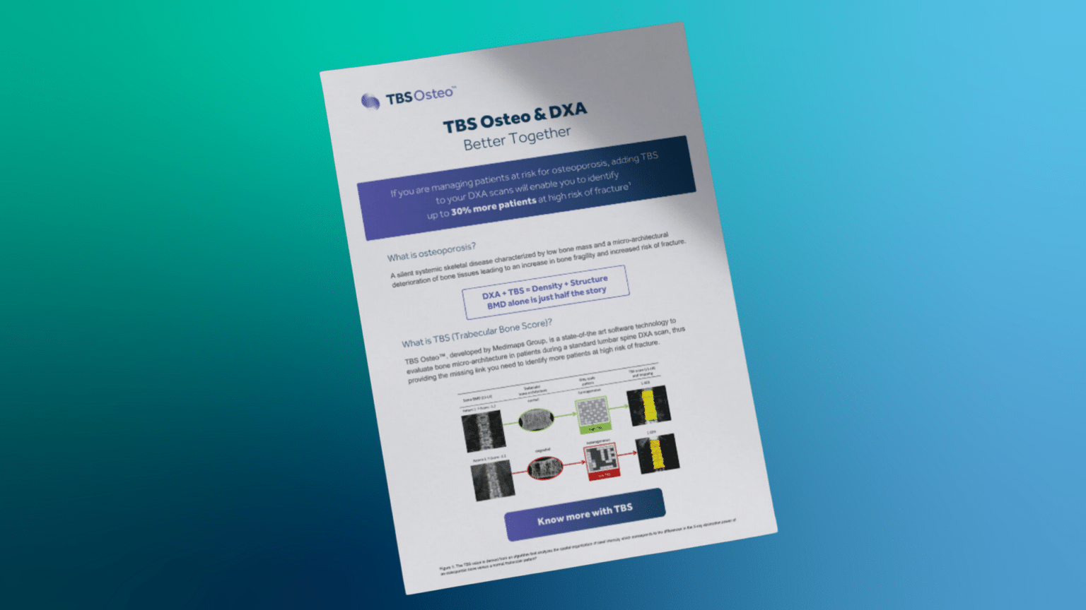 TBS educational kit - Medimaps